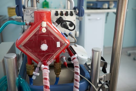 ELSA Monitor Used to Optimize ECMO Flow in 10-Year-Old Child