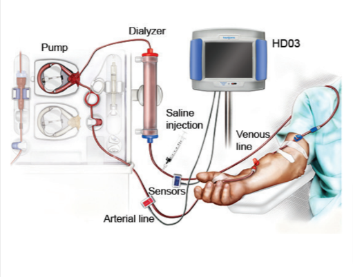 Effectively Detecting Recirculation in Hemodialysis Patients