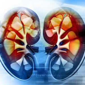 Scribner Shunt Ushers In New Era for End-stage Kidney Disease Treatment
