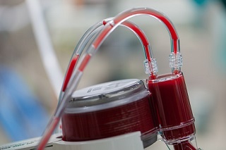 1st Validation of Internal Thoracic Artery Flow Measurement During CABG ...