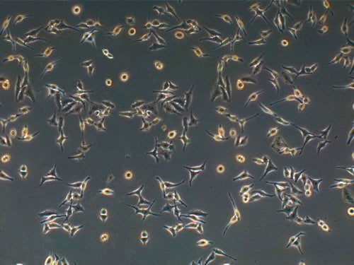 Henrietta Lacks and the Evolution of Informed Consent